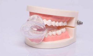 Tongue Retaining Devices to Stop Snoring: TRD's and TSD's?